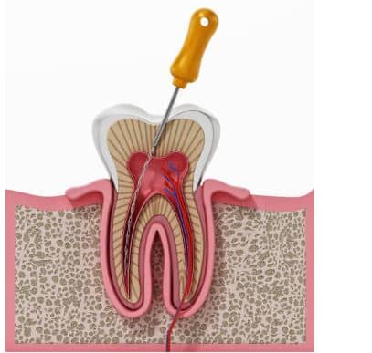 What Does Exposed Teeth Roots Mean? - ARC Dental Health